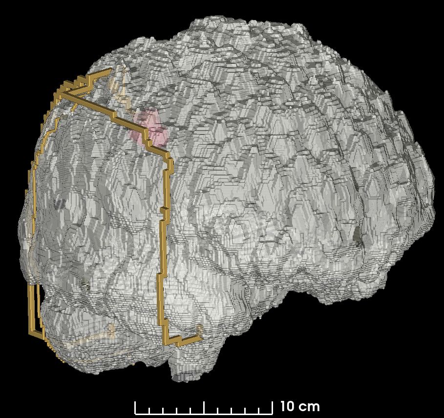 ‘Beyin Takımı’ İsimli Proje Grubu TEKNOFEST’te Finale Kaldı – KOSTÜ ...
